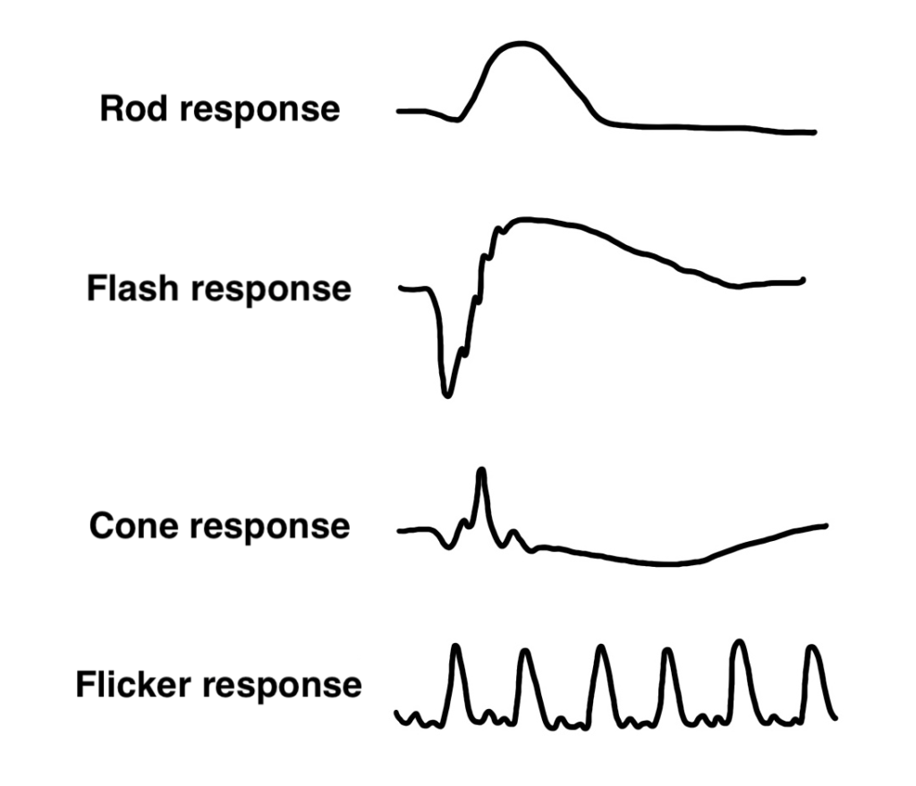 How to Read and Interpret ERG: A Practical Guide to Electroretinography ...