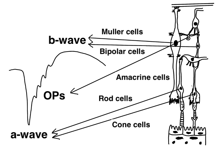 How to Read and Interpret ERG: A Practical Guide to Electroretinography ...