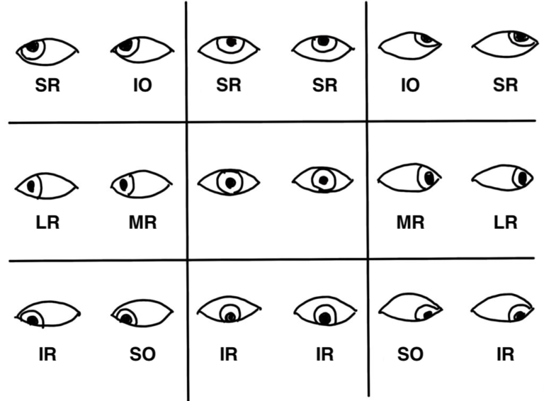Understanding Eye Movements: A Simple Guide to Extraocular Muscle ...